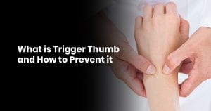 What is Trigger Thumb and How to Prevent it » Recurve Bow Hunting